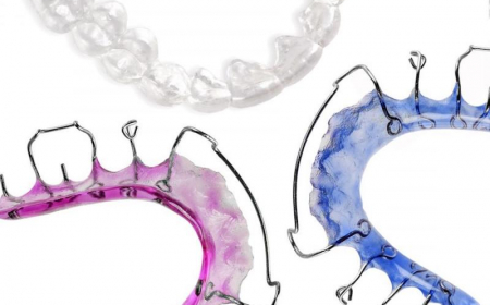 How to Clean Retainers: An Easy Guide