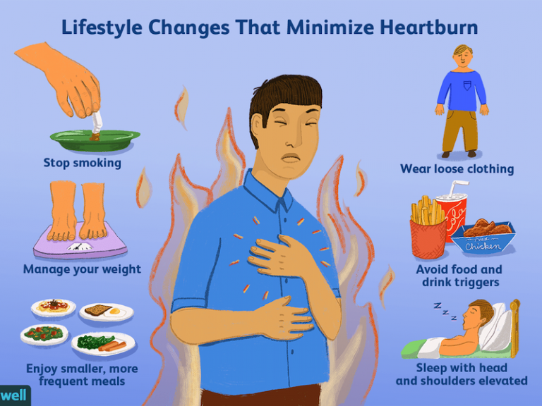 How To Get Rid Of Heartburn Fast: 7+ Natural Remedies And More