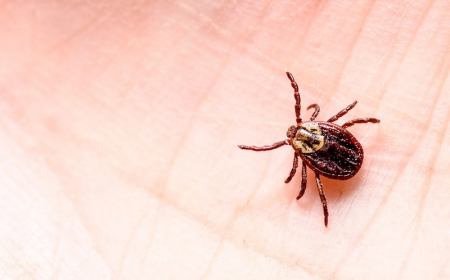 How To Remove a Tick: Everything You Need To Know