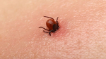How To Remove a Tick: Everything You Need To Know