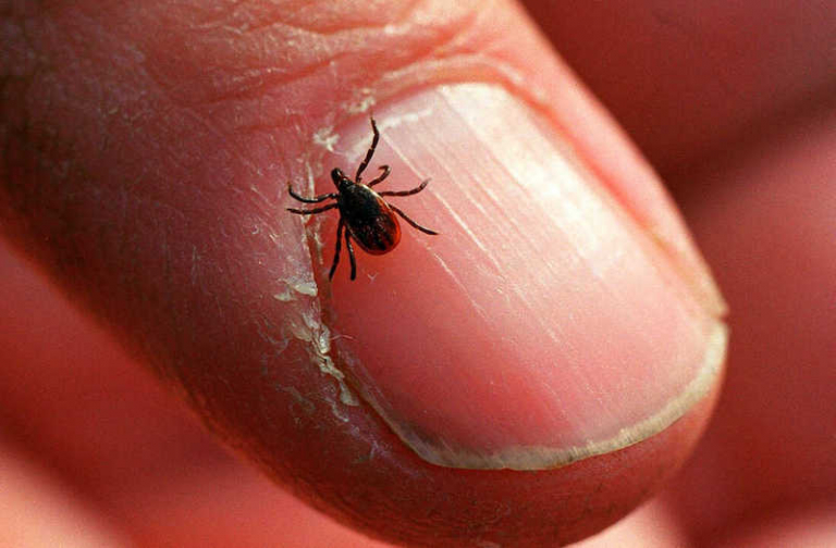 How To Remove a Tick: Everything You Need To Know